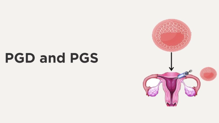 Preimplantation Genetic Diagnosis (PGD): A Conversation With A ...